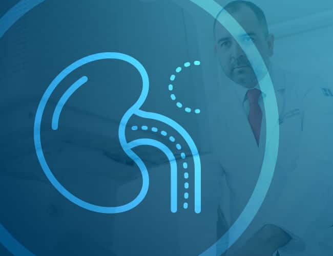 Ureteroscopía Flexible - Urólogo en Guadalajara : Dr. Alejandro ...